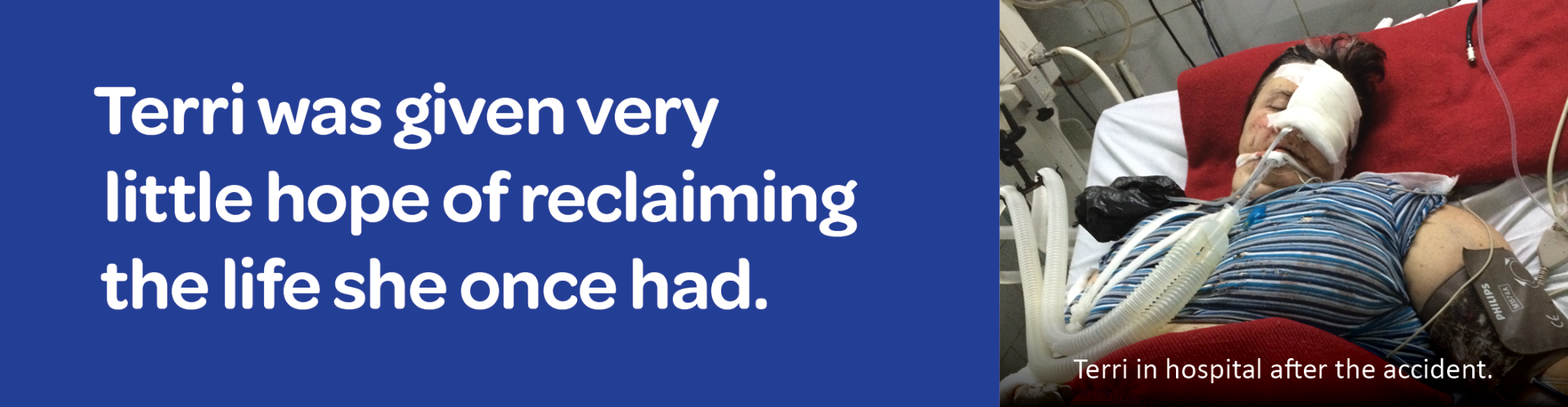 Transforming Brain Injury Treatment (new) - RAH Research Fund